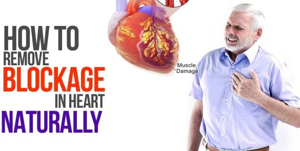 Top 5 Best Practice Guidelines For Heart Failure Management ...