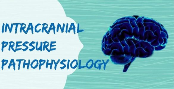 How To Reduce Cranial Pressure Naturally - Cardiovasculardiseasehub.com
