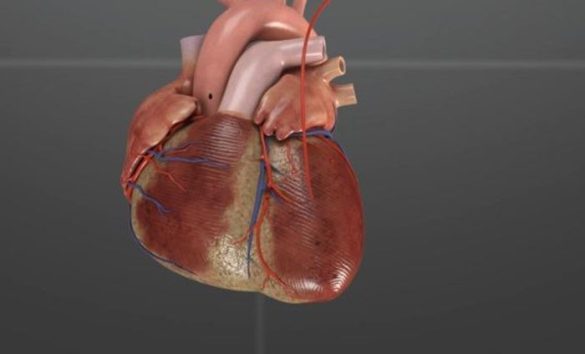 What Happens If Your Pacemaker Stops - Cardiovasculardiseasehub.com