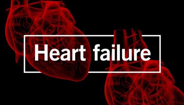 CVRx Reports Positive Two-Year Data For Heart Failure Treatment Device ...