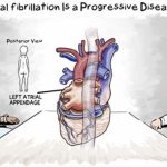 Smartcardia’s ECG Patch Receives FDA Approval For Outpatient Cardiac ...