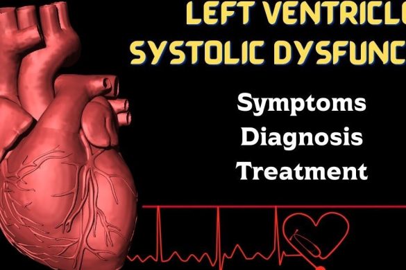 What Is Preserved Left Ventricular Systolic Function ...