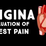 What Are The Backward Effects Of Left-Sided Heart Failure ...