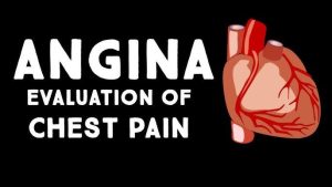 6 Major Causes Of Vasospastic Angina - Cardiovasculardiseasehub.com