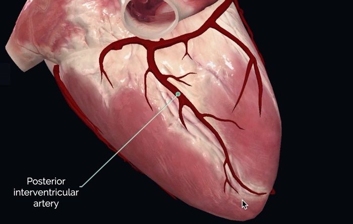 What Does The Left Anterior Descending Artery Do ...